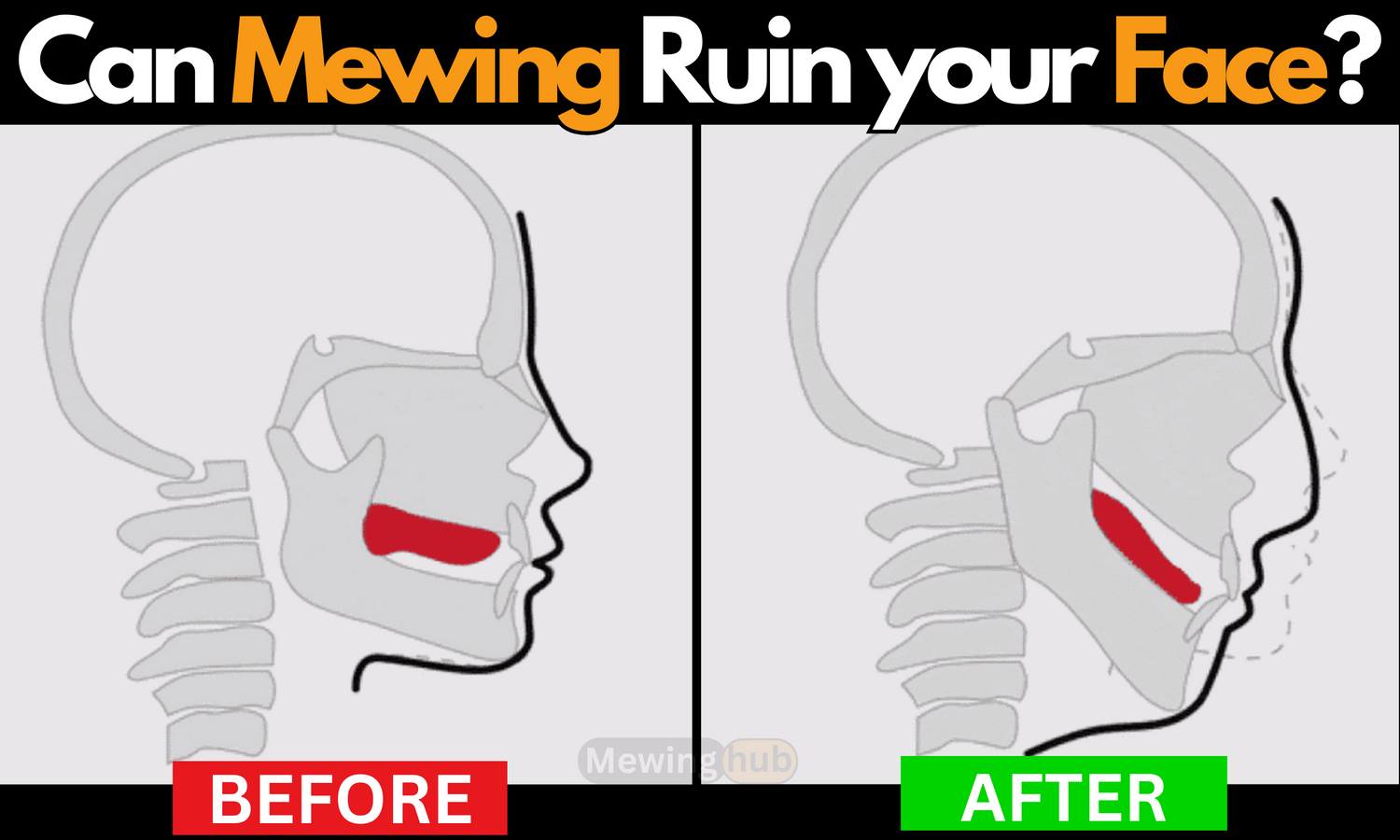 Can Mewing Ruin Your Face? Understanding the Risks of Mewing – Mewinghub